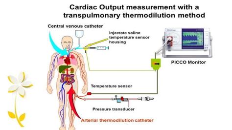 Cardiac Output Monitoring Pptx