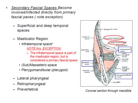 Infratemporal Space Infection Ppt Odontogenic Infection Powerpoint