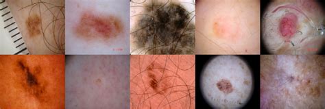 논문 리뷰 Mobileunetr A Lightweight End To End Hybrid Vision Transformer For Efficient Medical