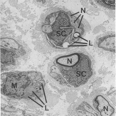 Electron Micrograph Of A Section Of Distal Rat Sciatic Nerve Download