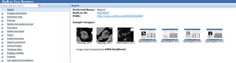 Radlex Radiology Lexicon Rsna