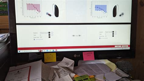 Costco Jabra Enhance Pro Frequency Lowering Hearing Aids Hearing Aid Forum Active Hearing