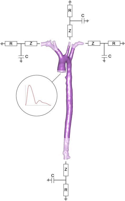 A Patient Specific 3d Computational Fluid Dynamics Model Of An Aorta