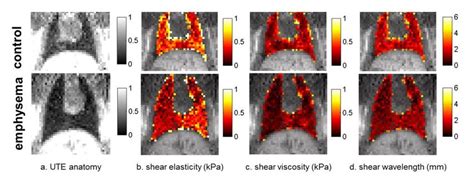 Mre Data Set On The Central Slice For Control Top Row And Download Scientific Diagram