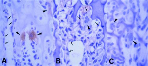 Immunohistochemical Staining Of Femur Sections For Vegfrs Longitudinal
