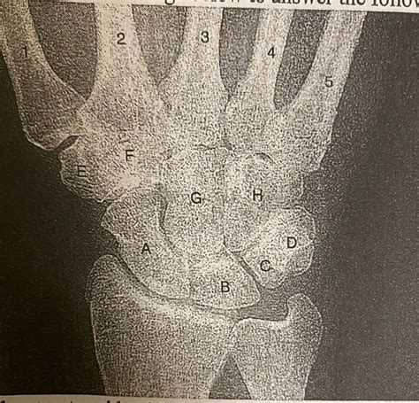 Worksheets Procedures Flashcards Quizlet