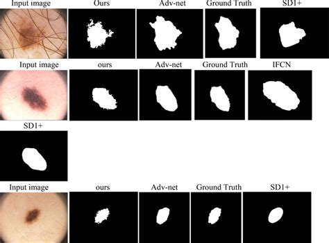 Visual Segmentation Result Comparison Of Segcaps With Other Methods