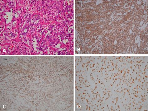 Initial Clinical Radiological Findings And Staging To Predict Prognosis