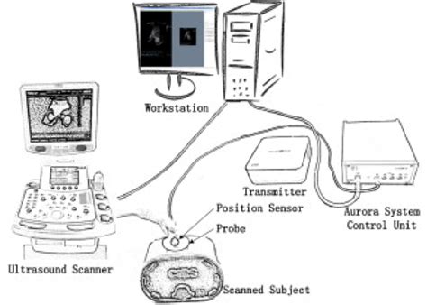 Freehand Three Dimensional Ultrasound Us Imaging System In The Assessment Of Scoliosis