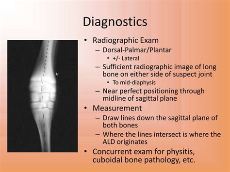 Angular Limb Deformity Ppt