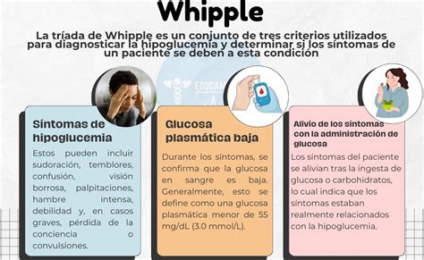 La Tríada De Whipple Para Diagnosticar Hipoglucemia Resúmenes Médicos