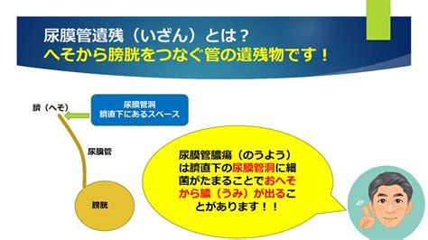 尿膜管膿瘍（のうよう）・臍炎（さいえん） （おへそから膿がでる、おへそが痛い） 評判の病院・評判のクリニック いきいきねっと