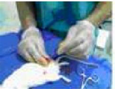 Intra Medullary Insertion Of 1 6 Mm K Wire Download Scientific Diagram