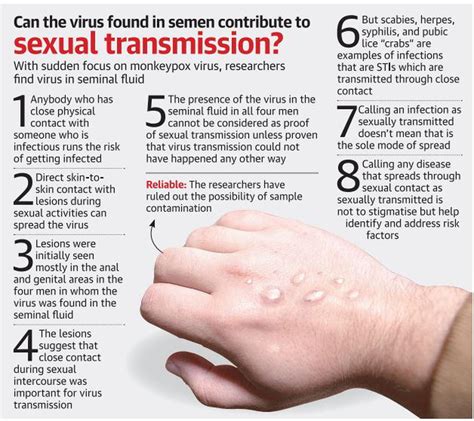 Is Monkeypox A Sexually Transmitted Infection The Hindu