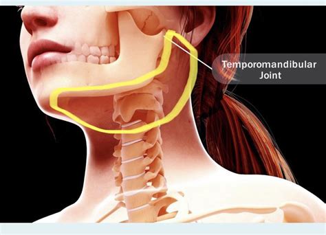 109 Best R Tmj Images On Pholder TMJ Pain Be Like