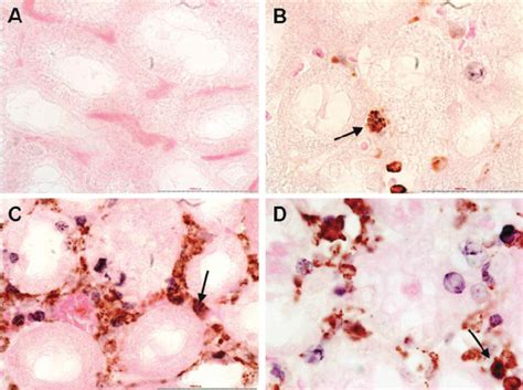 Ed1 Ki 67 Double Staining A Absence Of Ki 67 Ed1 Doubly Stained Download Scientific