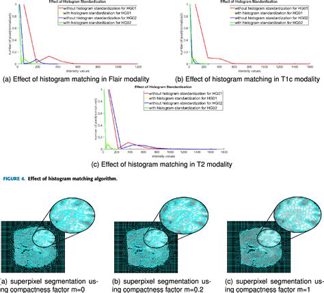 Figure 1 From Automated Brain Tumor Segmentation Based On Multi Planar Superpixel Level Features