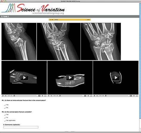 Example Of Radiograph With CT Scan Uploaded To The Research Group S