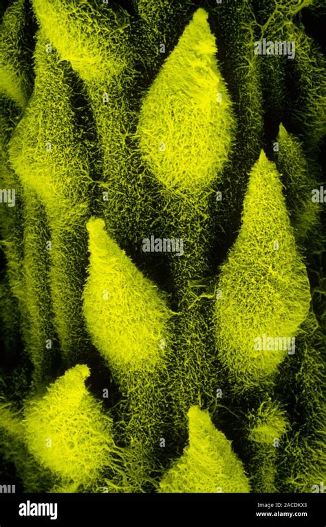False Colour Scanning Electron Micrograph Of The Leaf Surface Of Marram