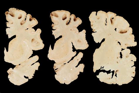 Sex Allegations Against Roy Moore Send Republicans Reeling The New York Times