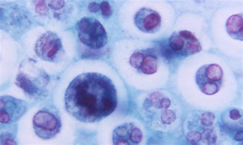 Novel Guidelines Help Select Optimal Deconvolution Method Bcm