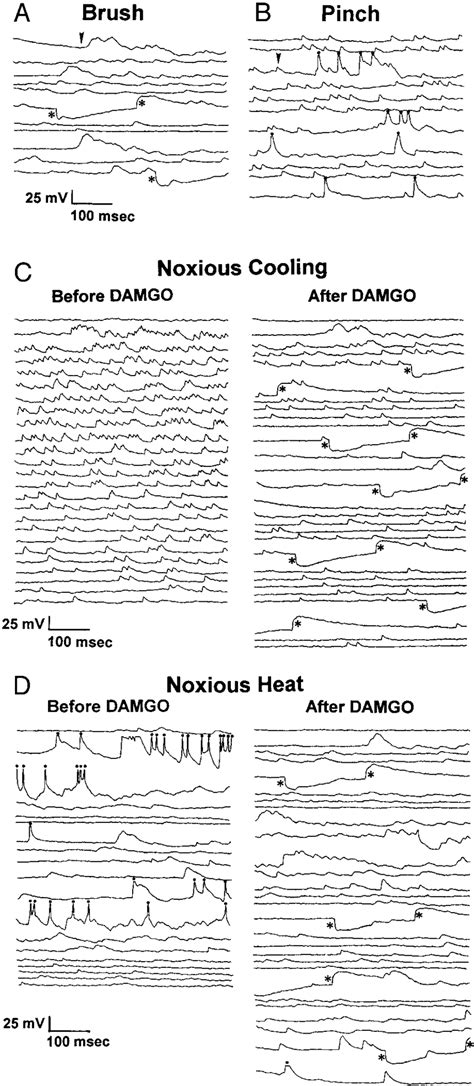 In Vivo Patch Clamp Recording From Nociceptive Specific Neuron In Download Scientific Diagram