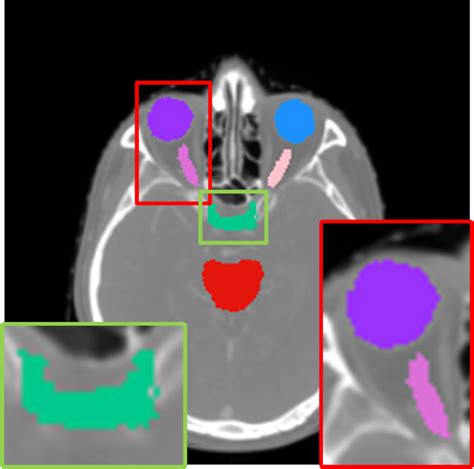 Some Segmentation Examples Of Comparative Experiment Gt Is Ground