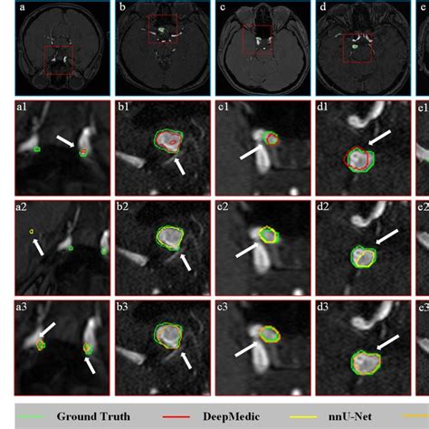 Typical Visualizations Of Segmentation Performances Of Different Models Download Scientific