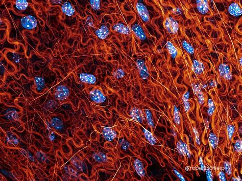 Fascia New Breakthrough In Fascia And Extracellular Matrix Research