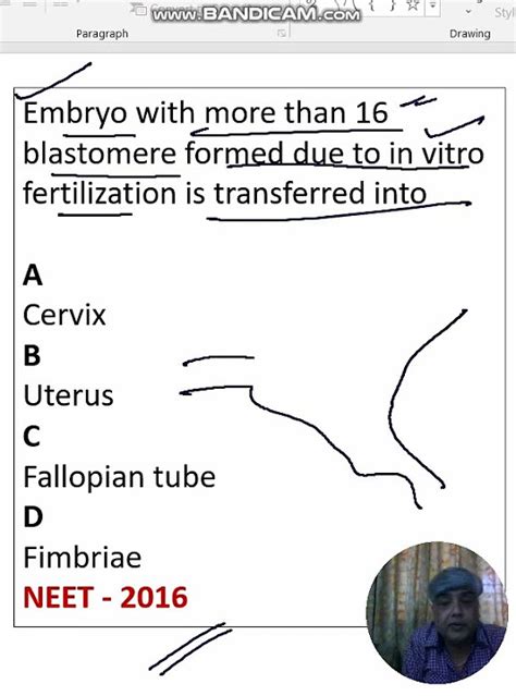 Embryo With More Than 16 Blastomere Formed Due To In Vitro