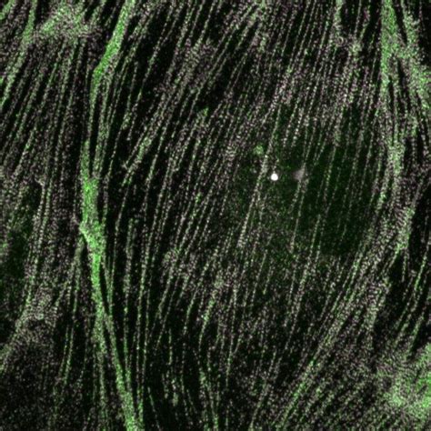 Myosin In Fixed Cells Galleries Nikon Instruments Inc