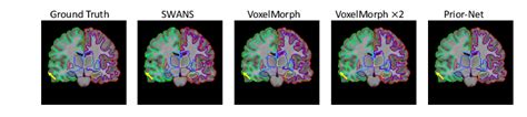 example mr slice of brain structure annotations and segmentation maps