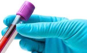 What Is CMP Blood Test And Normal Results