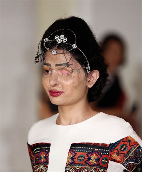 Acid Attack Survivor Reshma Qureshi Walked The Runway At New York