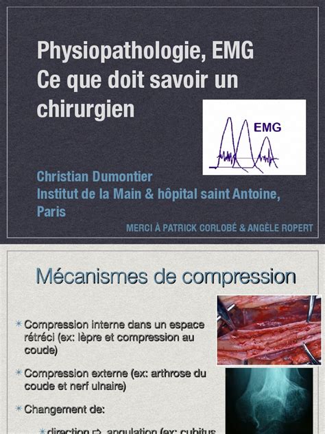 Emg Et Compression Nerveuse Du Coude Pdf Électromyogramme Myéline