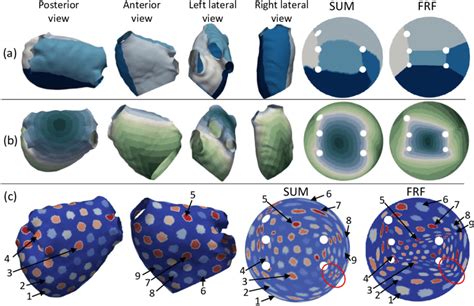 flattening examples of 3d la with different synthetic texture patterns