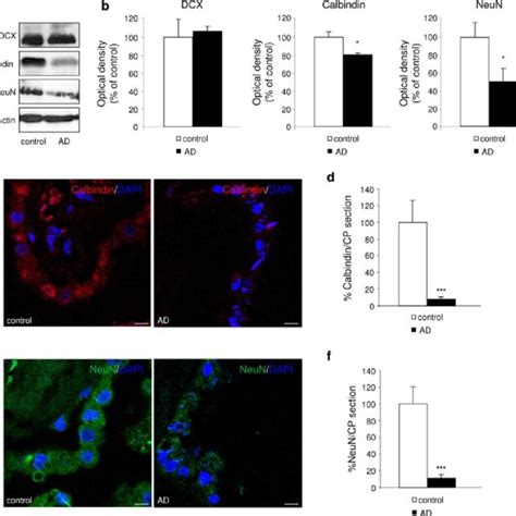 Cell Proliferation In The Choroid Plexus Of App Ps1 Mice A