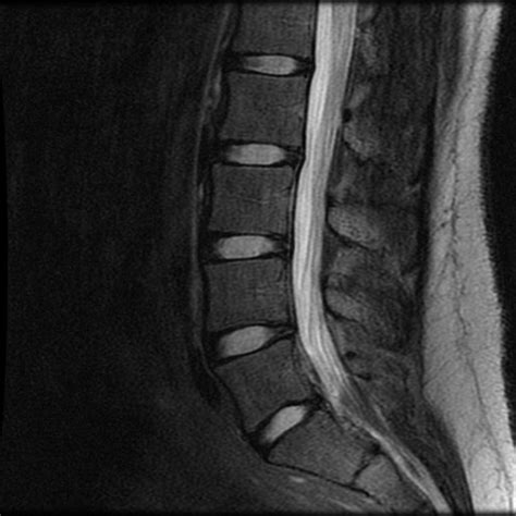 Matlab Connected Component Analysis Error Stack Overflow