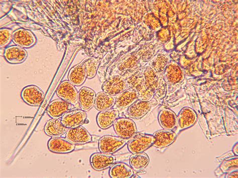 Stripe Rust Farm Fungal Pathogens In Olympia