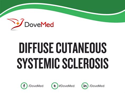 Diffuse Cutaneous Systemic Sclerosis DcSSc DoveMed