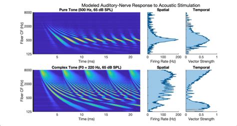 Modeled Auditory Nerve Response To Acoustic Stimulation For Pure And Download Scientific