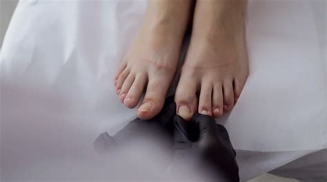 ონიხომიკოზის ფრჩხილის Nuage Clinique კლინიკა ნუაჟი