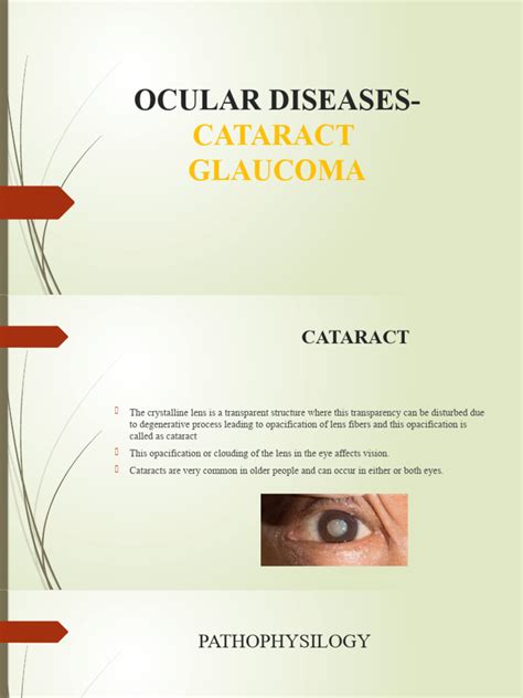 Age Related Cataract And Glaucoma Pdf Glaucoma Cataract