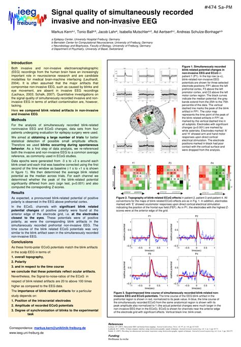 Pdf Signal Quality Of Simultaneously Recorded Invasive And Non Invasive Eeg