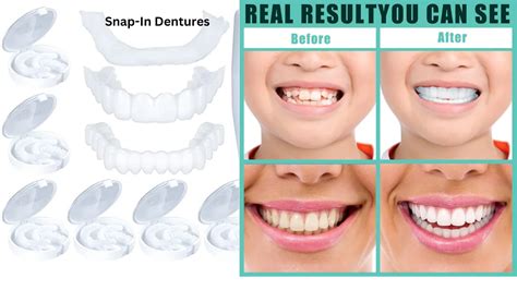 Best Snap On Teeth You Can Eat With Detroit Chinatown
