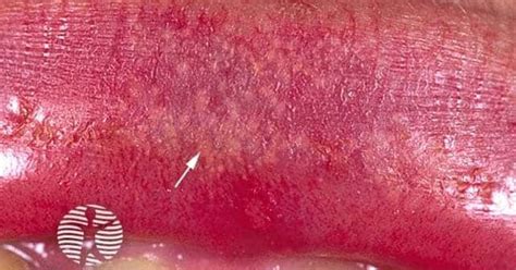 Case1 Image