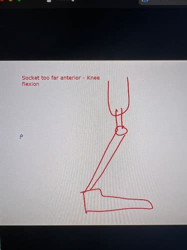 Npte Review Flashcards Quizlet