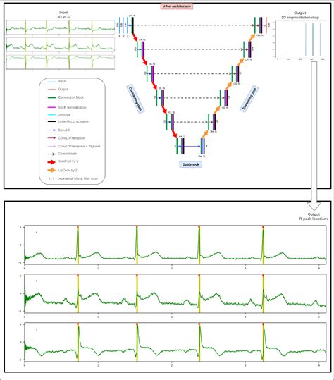 Figure 3 From A Deep Learning Architecture Using 3d Vectorcardiogram To