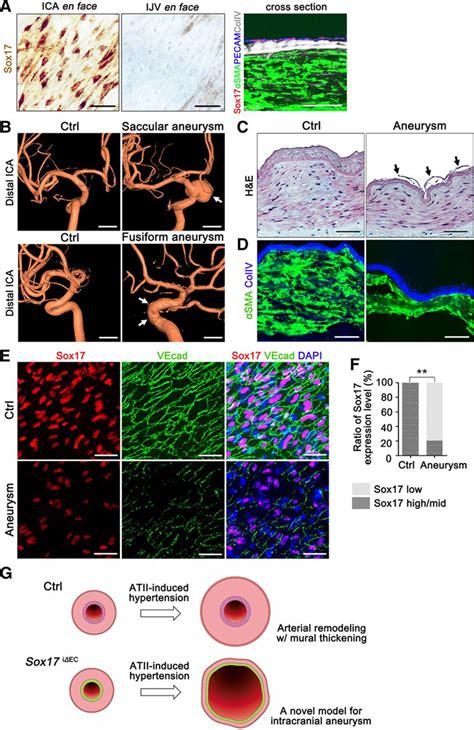 Deficiency Of Endothelium Specific Transcription Factor Sox17 Induces