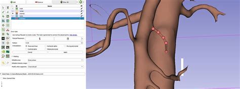 draw tube for vessel segmentation does not show support 3d slicer